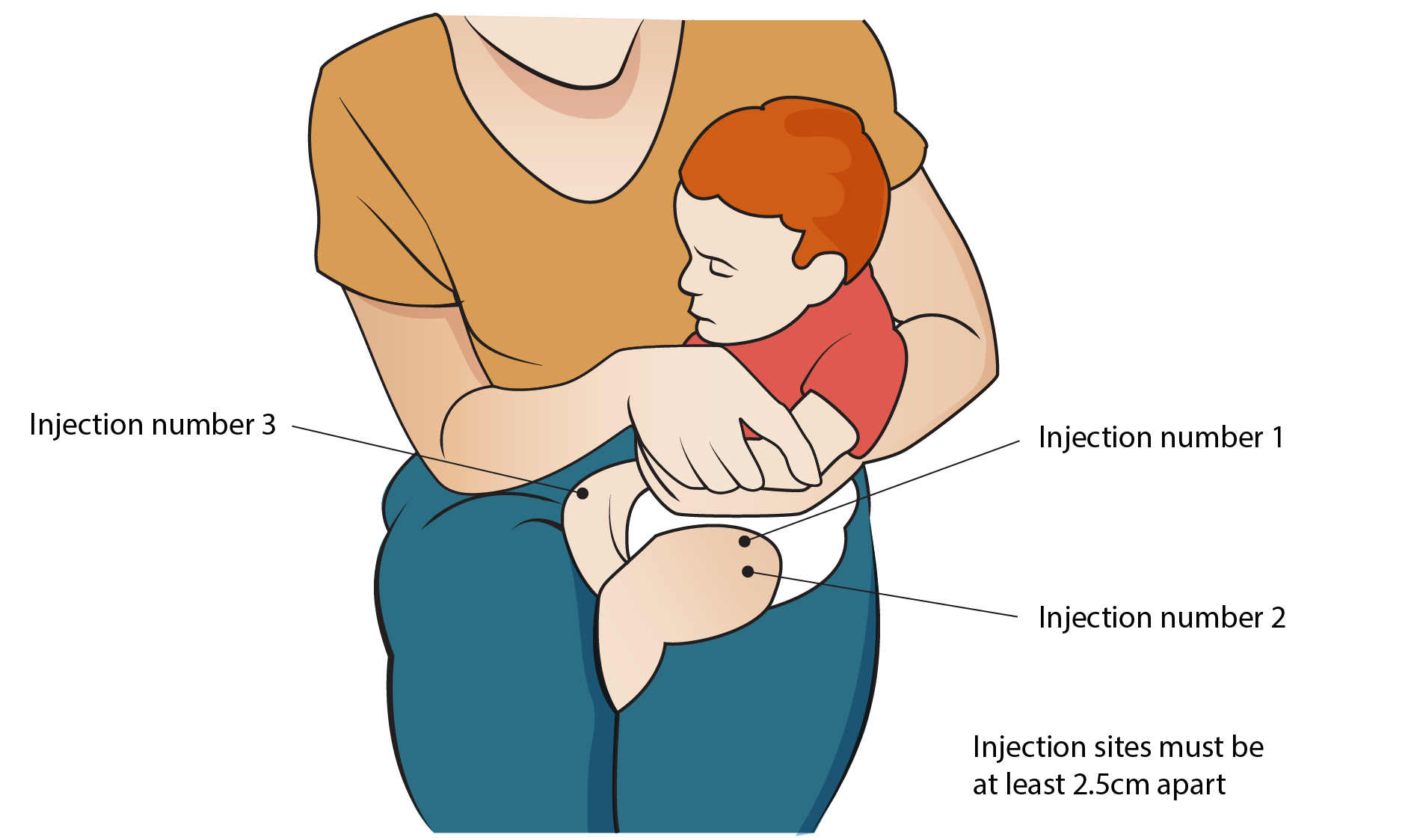 Figure Recommended Technique For Giving Multiple Vaccine Injections 